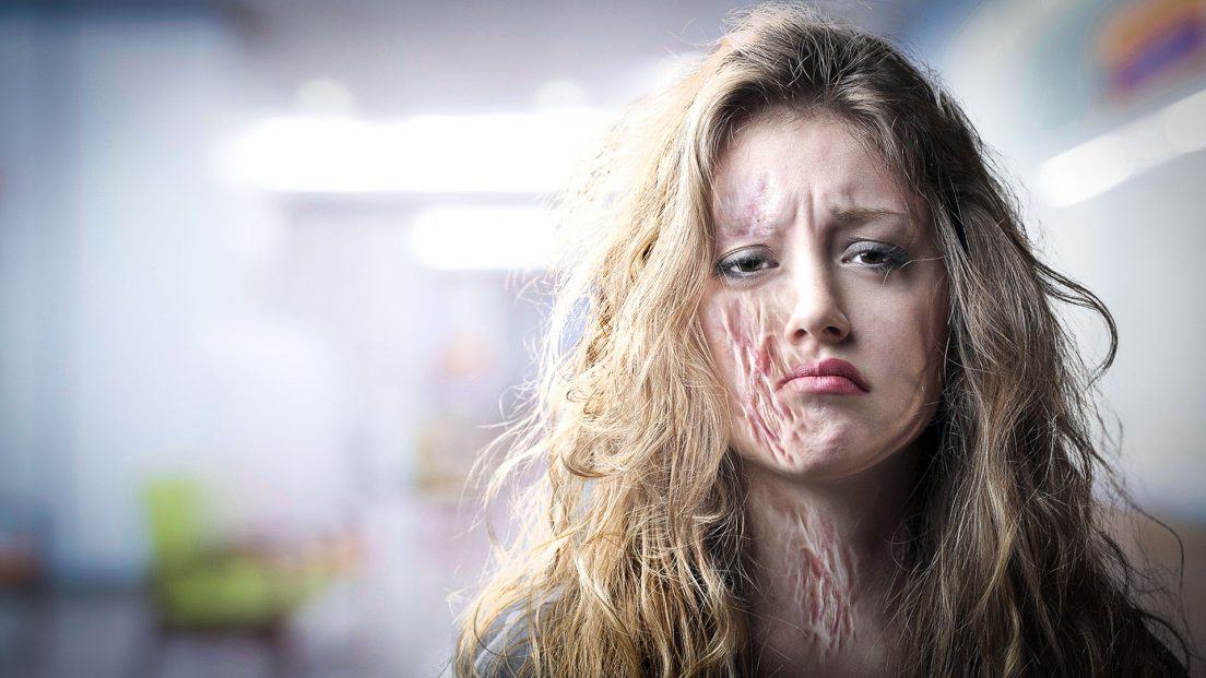How to Survive an Acid Attack | What If Show