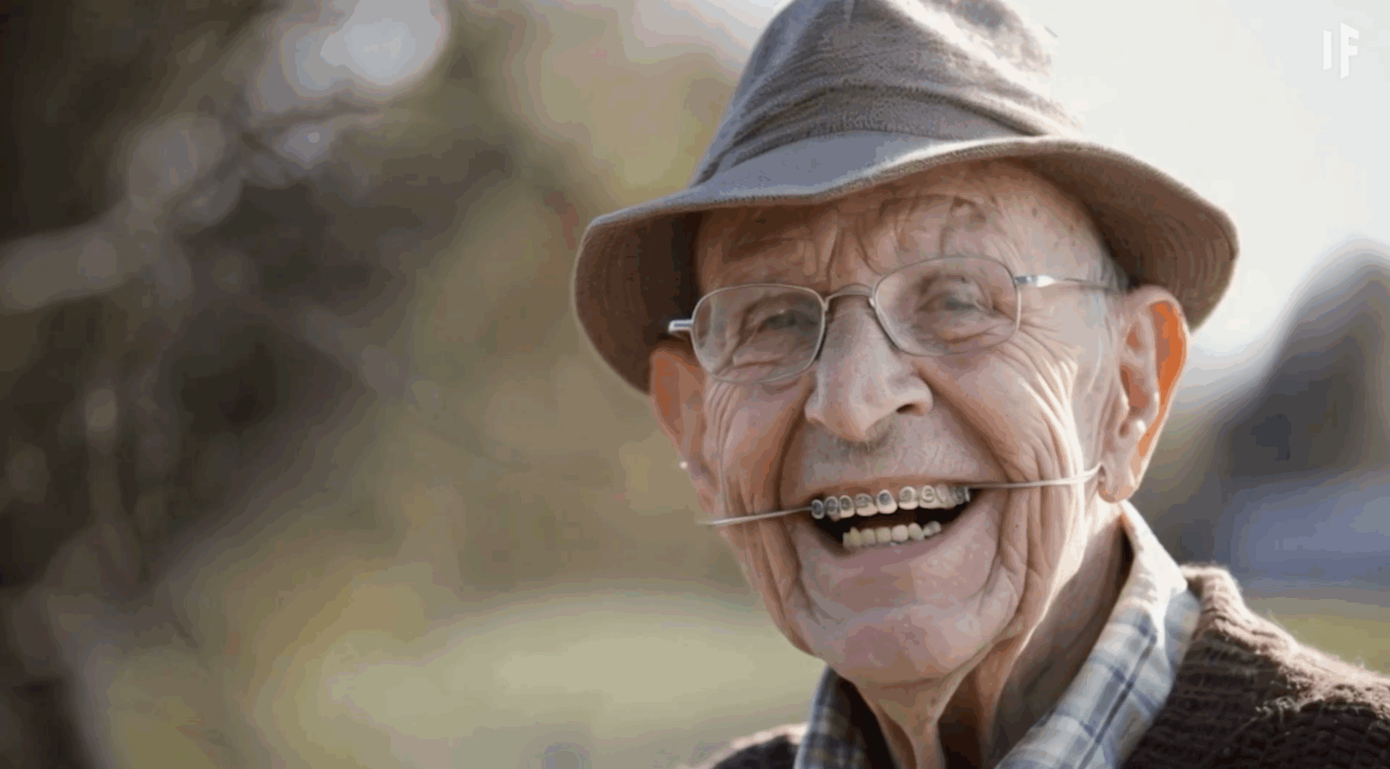 50 Years With Braces: What Happens When You Never Take Them Off | What ...