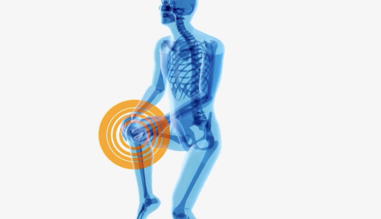 Stanford Scientists Have Found a Way to Regrow Cartilage and Reverse ...